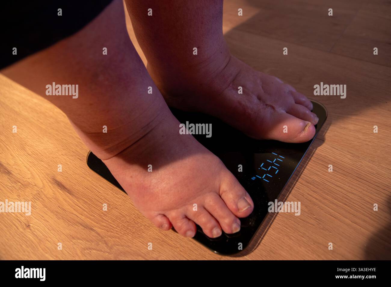 Untermerzbach, Germany. 15th Mar, 2025. An overweight woman with ...