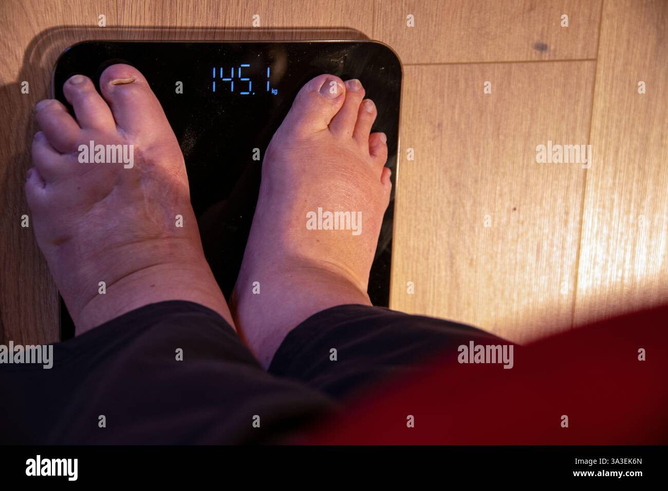 Untermerzbach, Germany. 15th Mar, 2025. A very overweight woman with ...