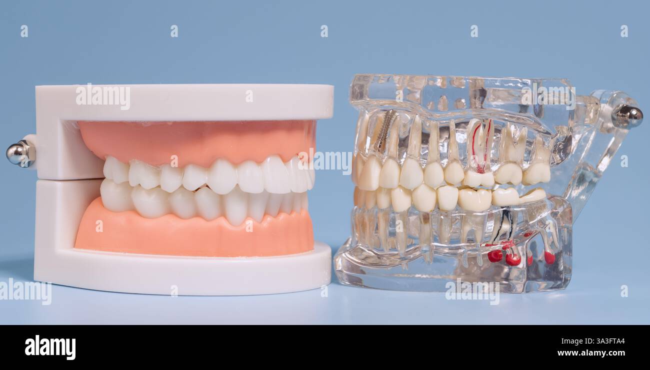 Close-up of two dental models, one opaque and one transparent ...