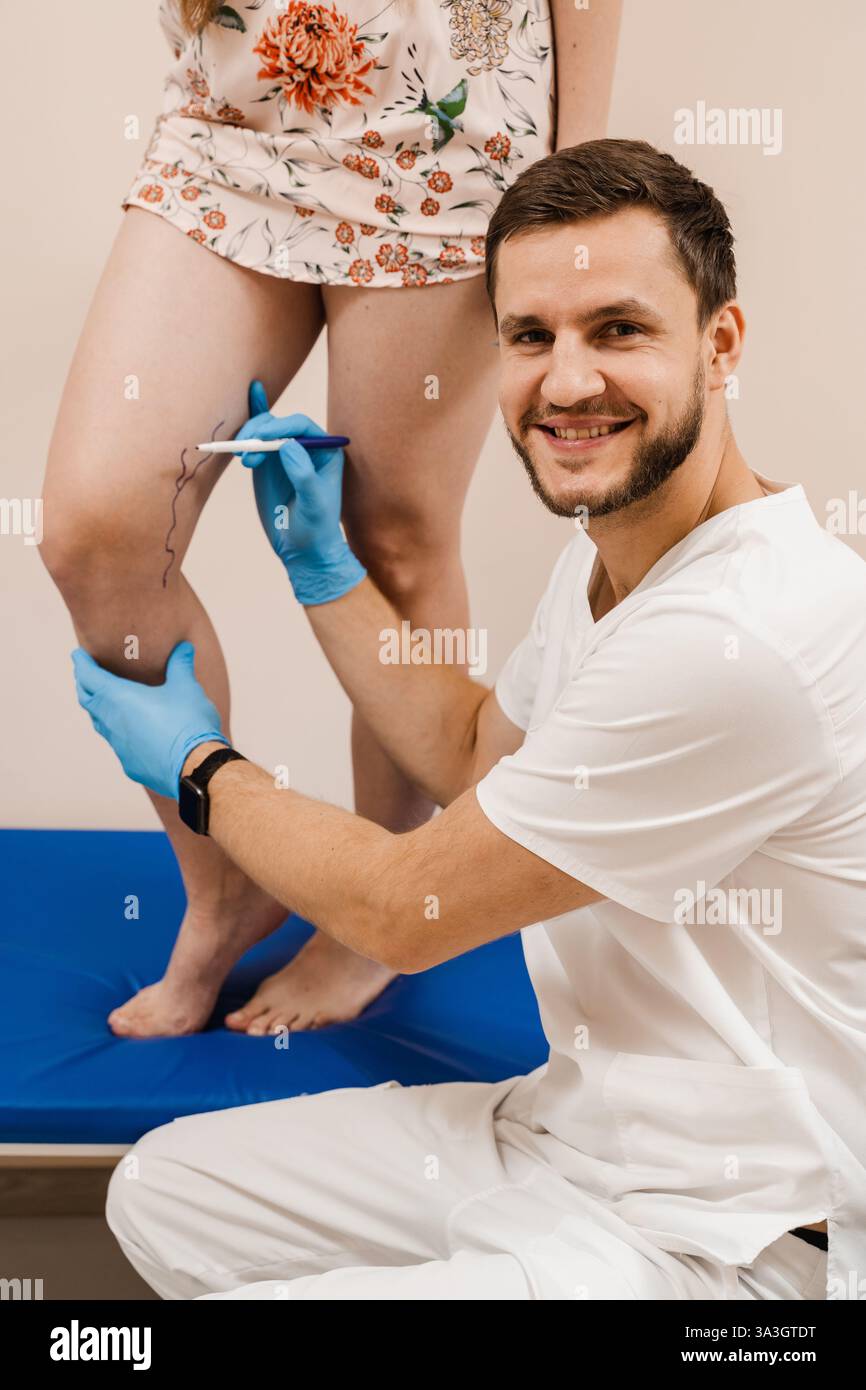 The vascular surgeon is marking leg veins. Vein markup. The ...