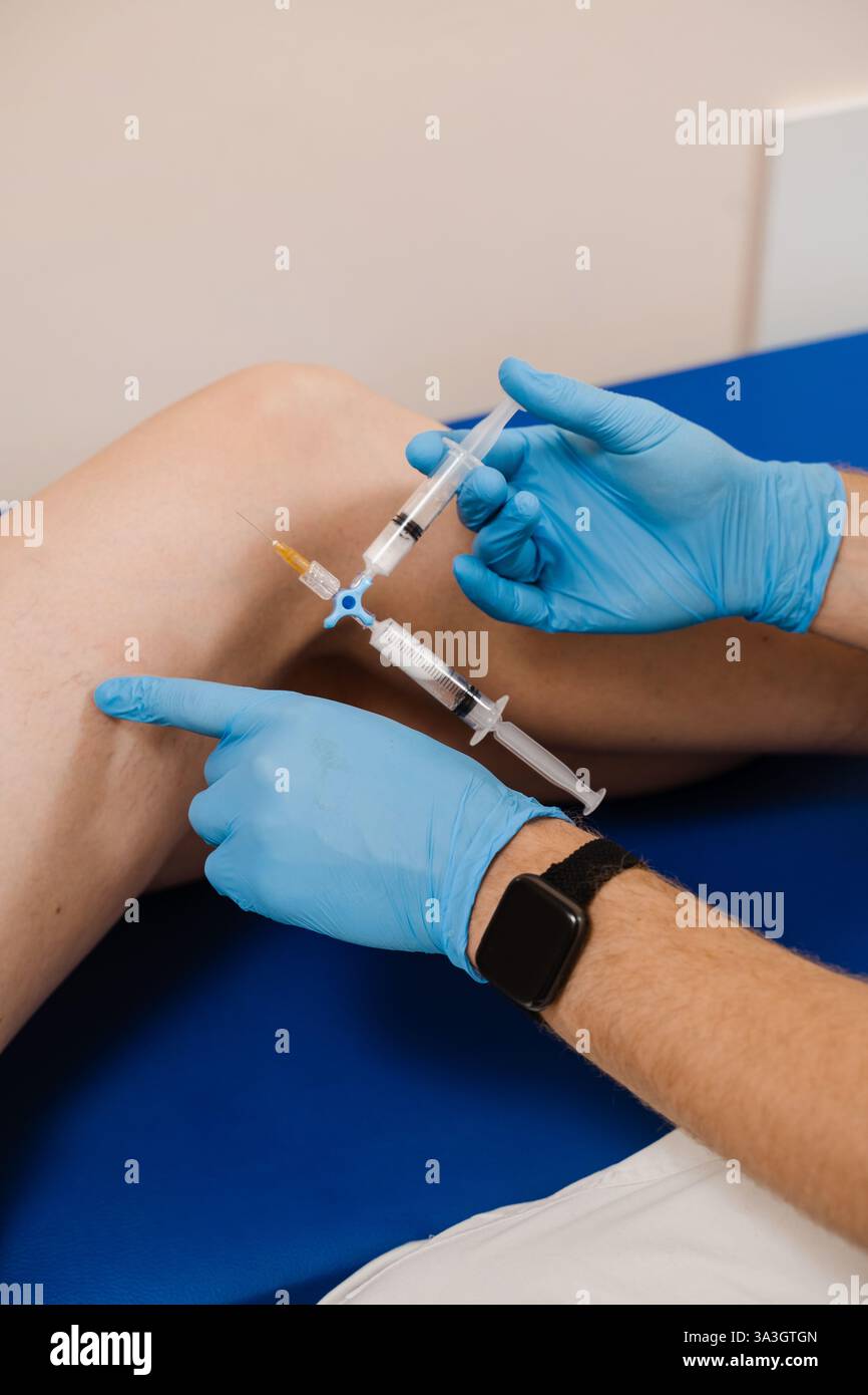Sclerotherapy injecting into the varicose or spider vein on leg to ...