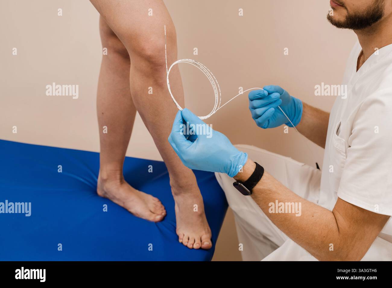 Vascular surgeon is holding EVLT Red laser optical fiber for endovenous ...