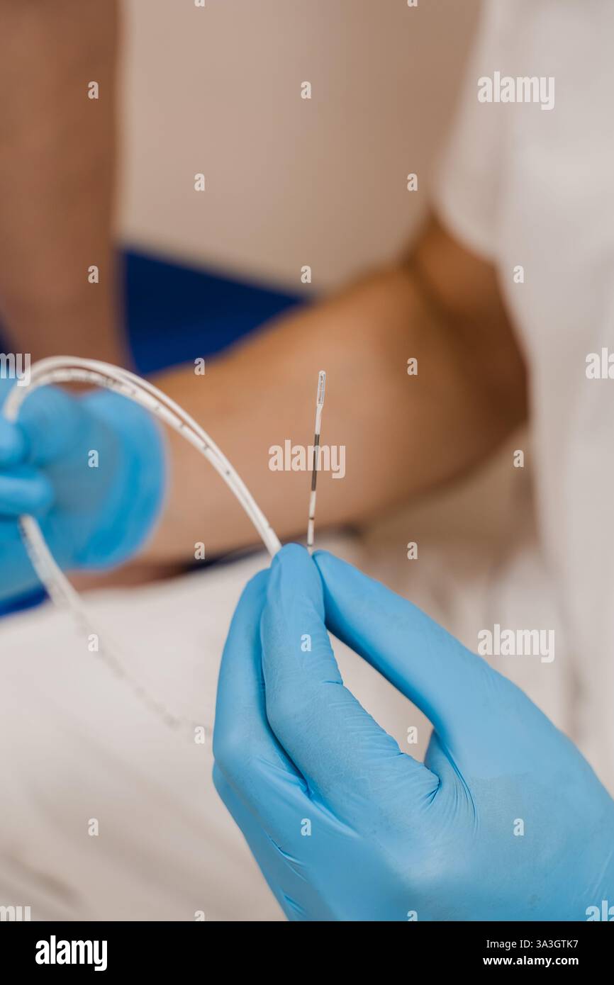 EVLT Red laser optical fiber for endovenous laser coagulation ...