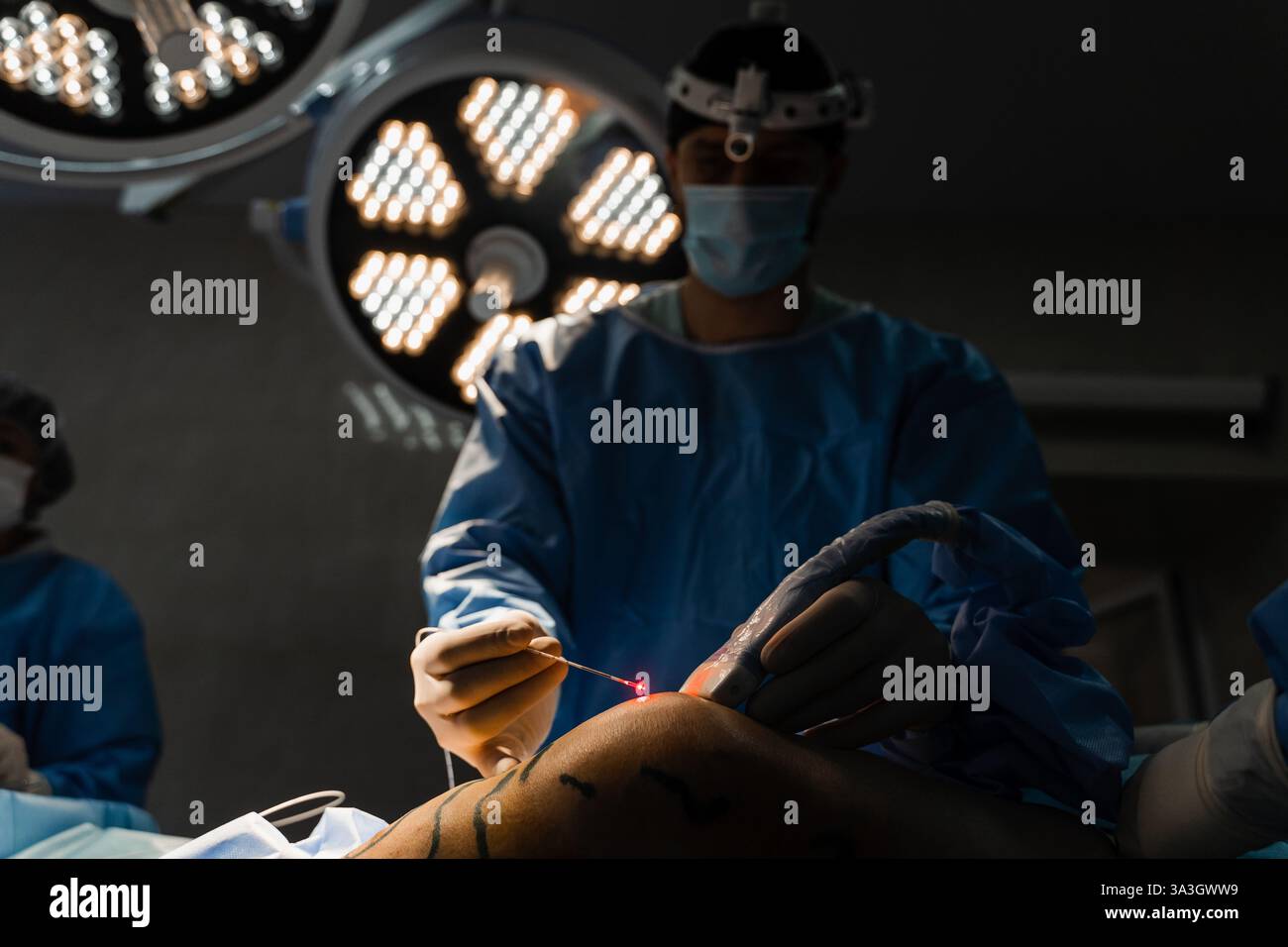 Vascular surgeon is operating leg using EVLT Red laser optical fiber ...