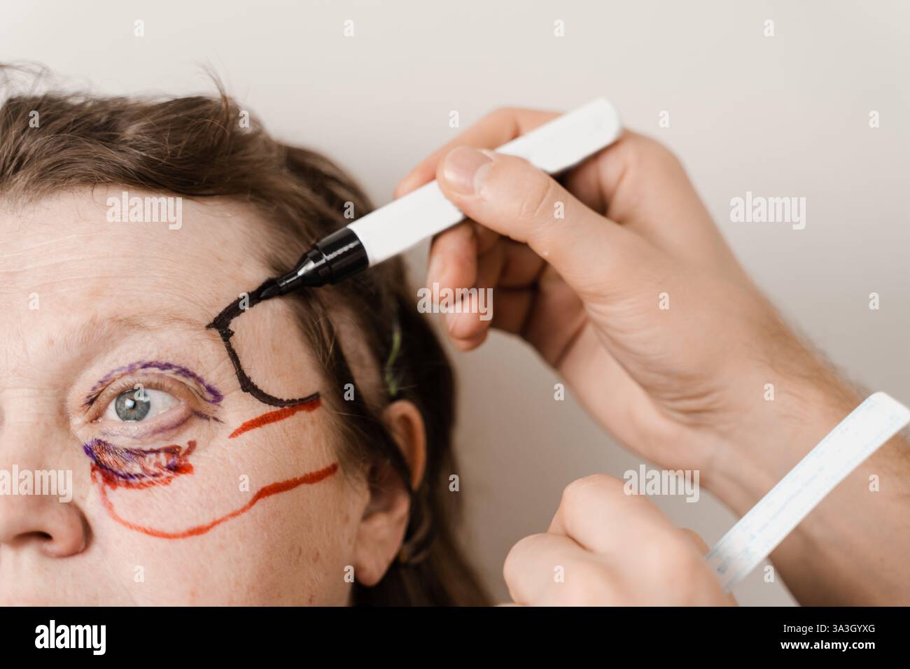 Browpexy markup close-up on the face for brow lift before the plastic ...