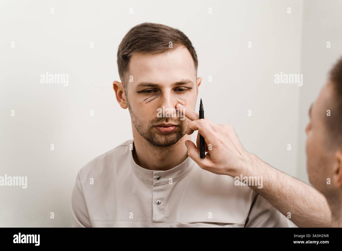 Male blepharoplasty and lower eyelid lift and hernia removal markup on ...