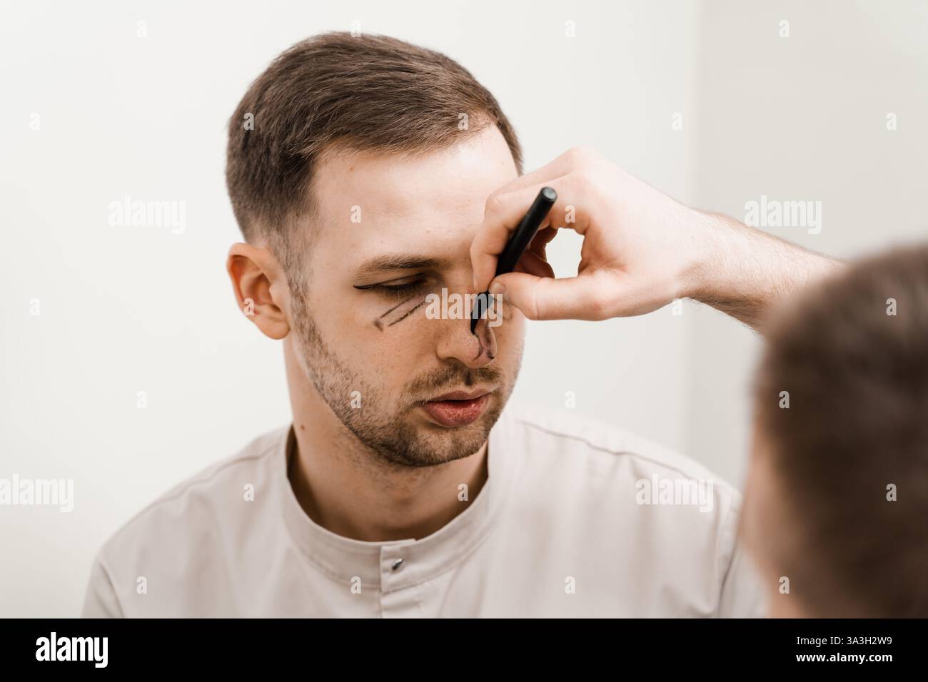 Male rhinoplasty markup close-up. Blepharoplasty with hernia removal ...