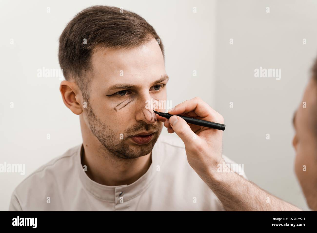 Male rhinoplasty markup close-up. Blepharoplasty with hernia removal ...