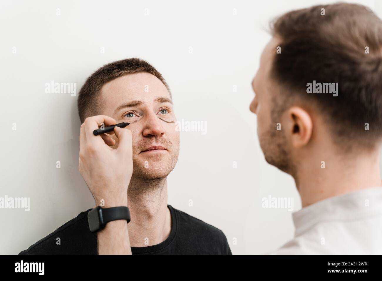 Male blepharoplasty and lower eyelid lift and hernia removal markup on ...