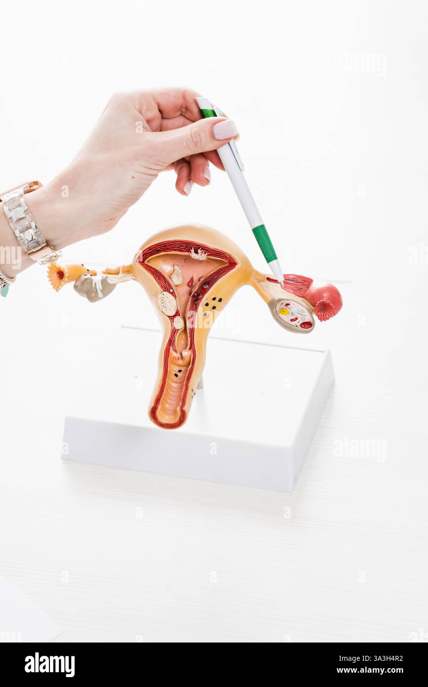 Realistic uterus model on white background close-up. Consultation with ...