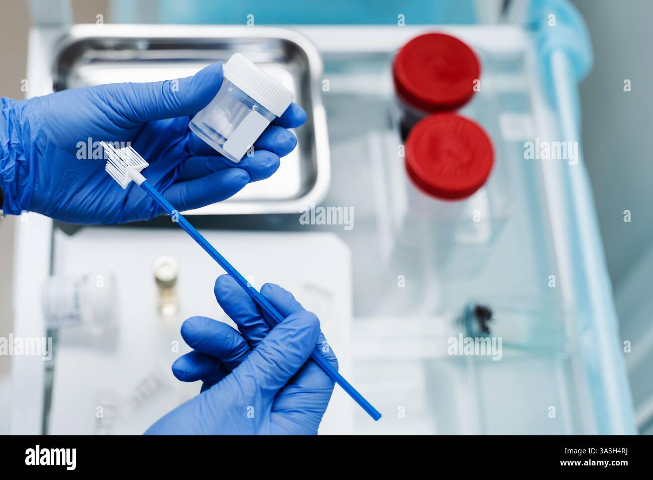 Gynecological cytology Pap smear test and cytobrush in hands of ...