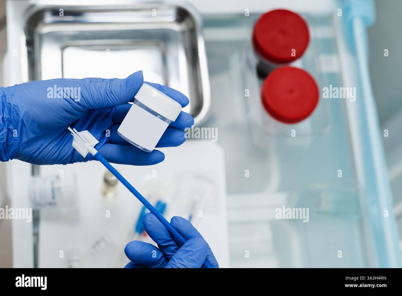 Gynecologist is holding flask for cytology Pap smear test in hands ...