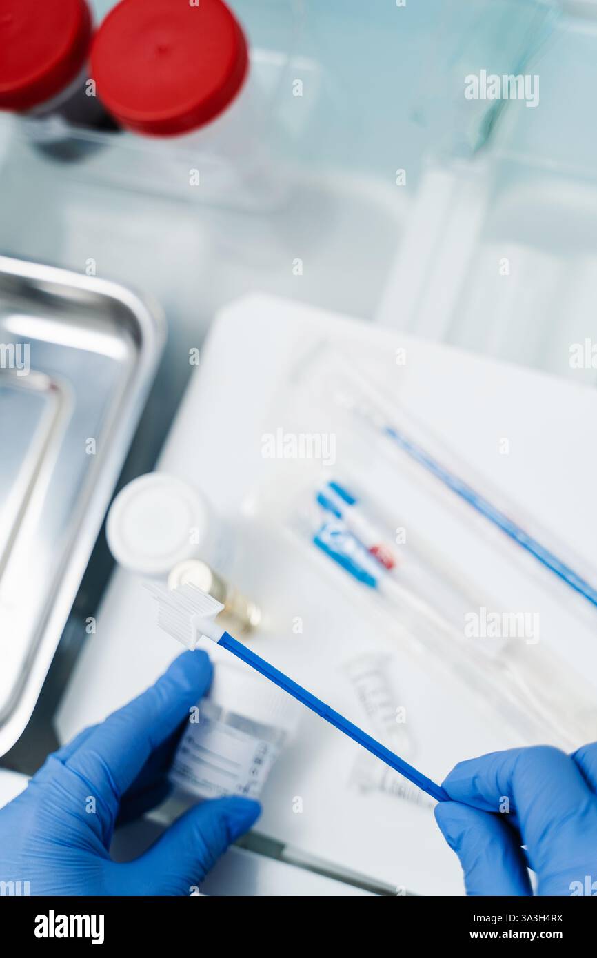 Gynecologist is holding flask for cytology Pap smear test in hands ...