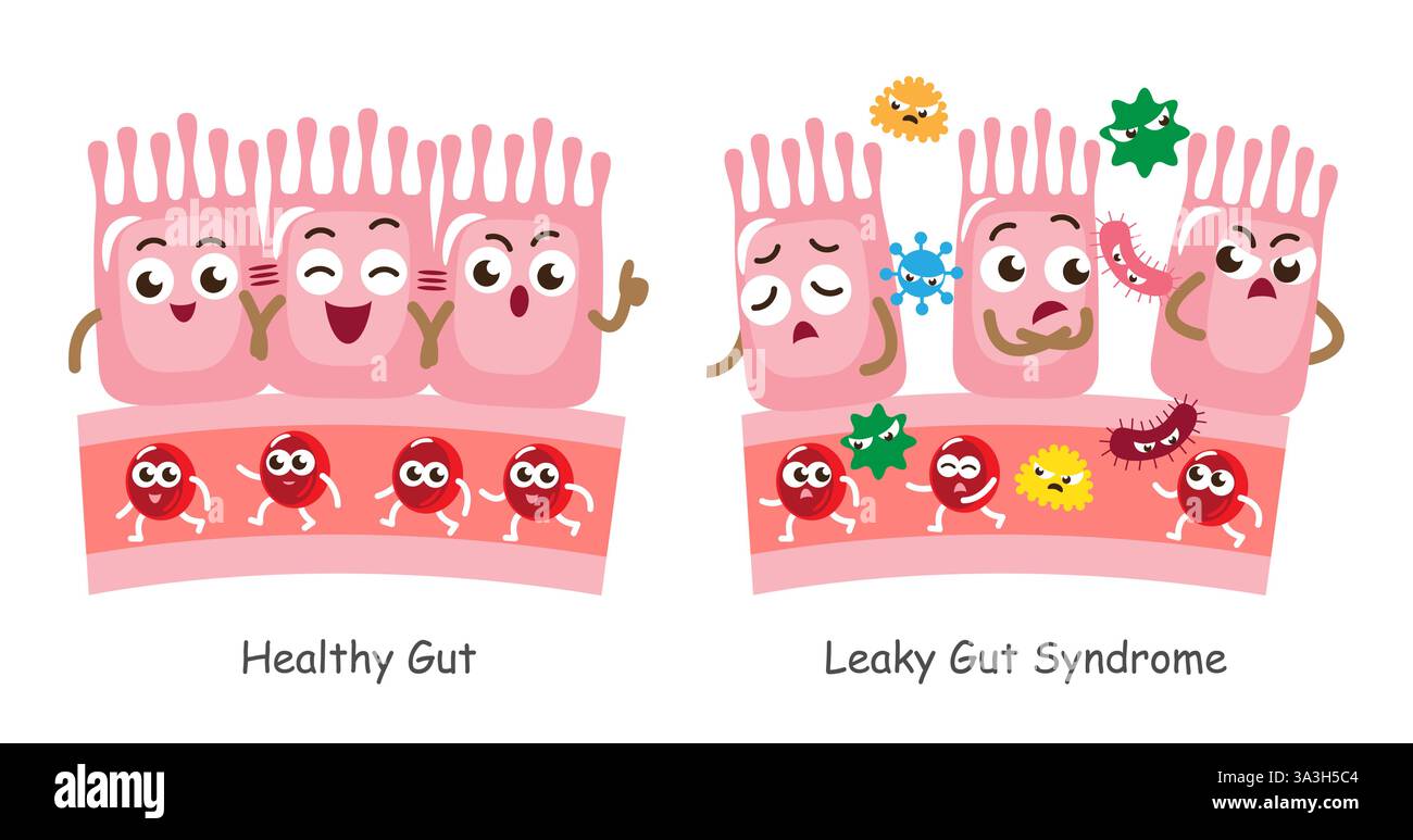 Leaky gut syndrome and healthy gut . Cute medical cartoon character ...
