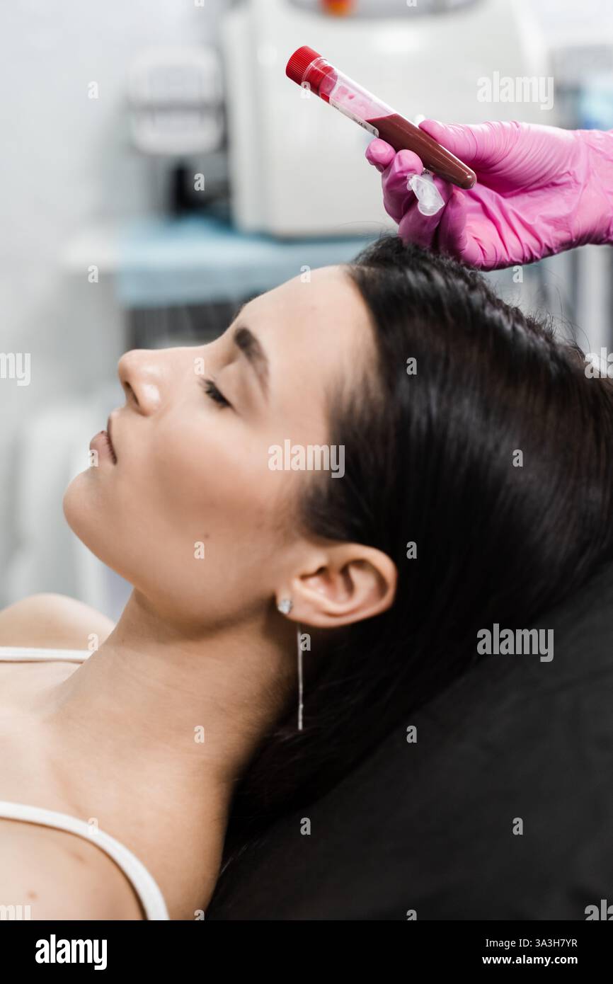 Platelet Rich Plasma PRP for improves skin volume and texture, reduces ...