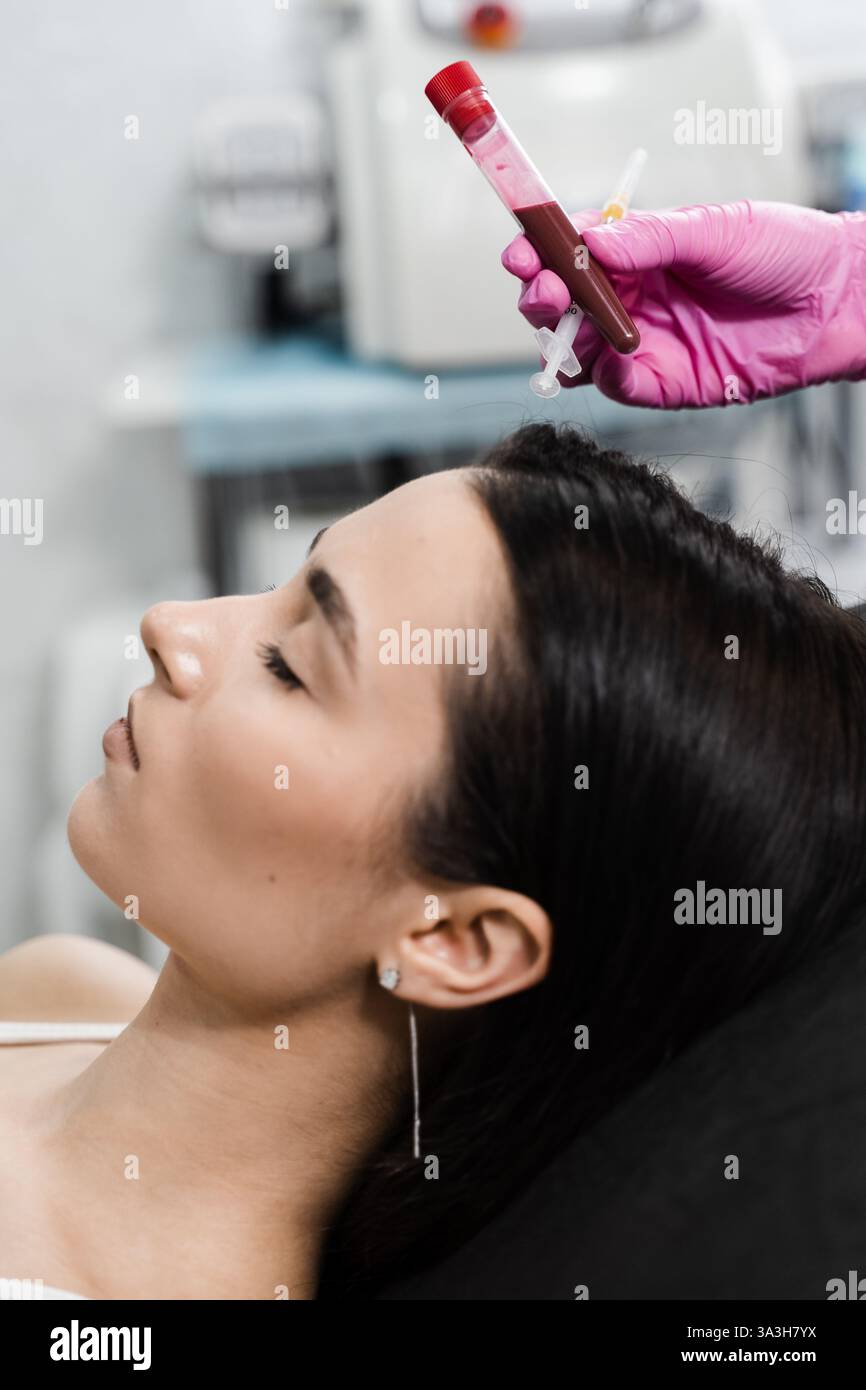 Cosmetologist with test tube with blood and plasma for PRP Platelet ...