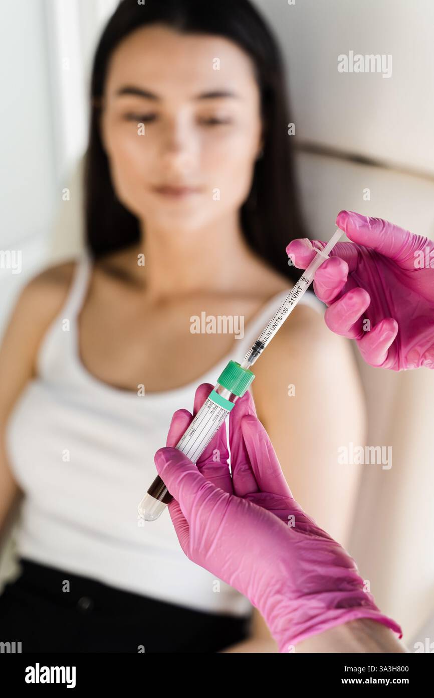 Cosmetologist with test tube with blood and plasma for PRP Platelet ...