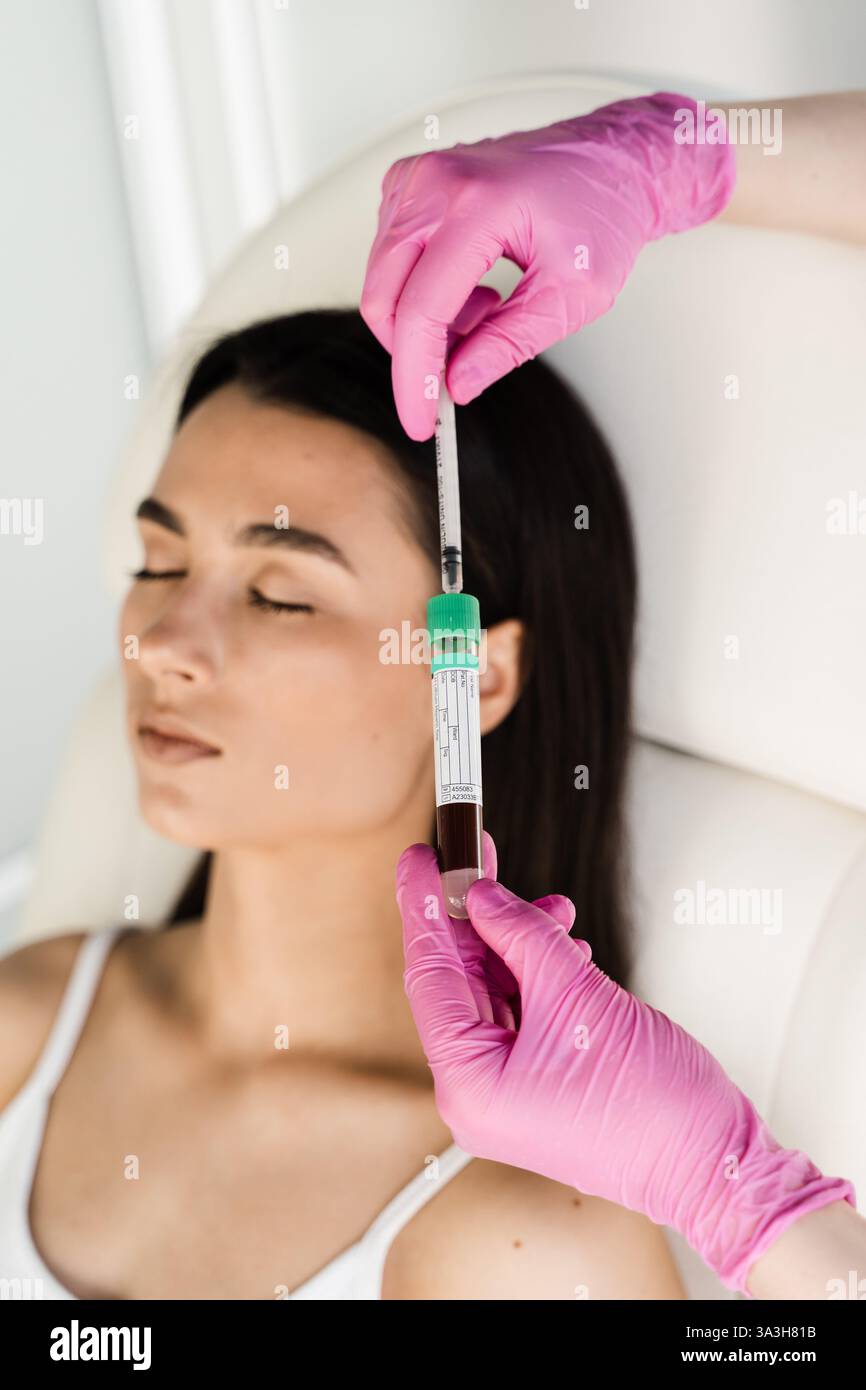 Cosmetologist with test tube with blood and plasma for PRP Platelet ...