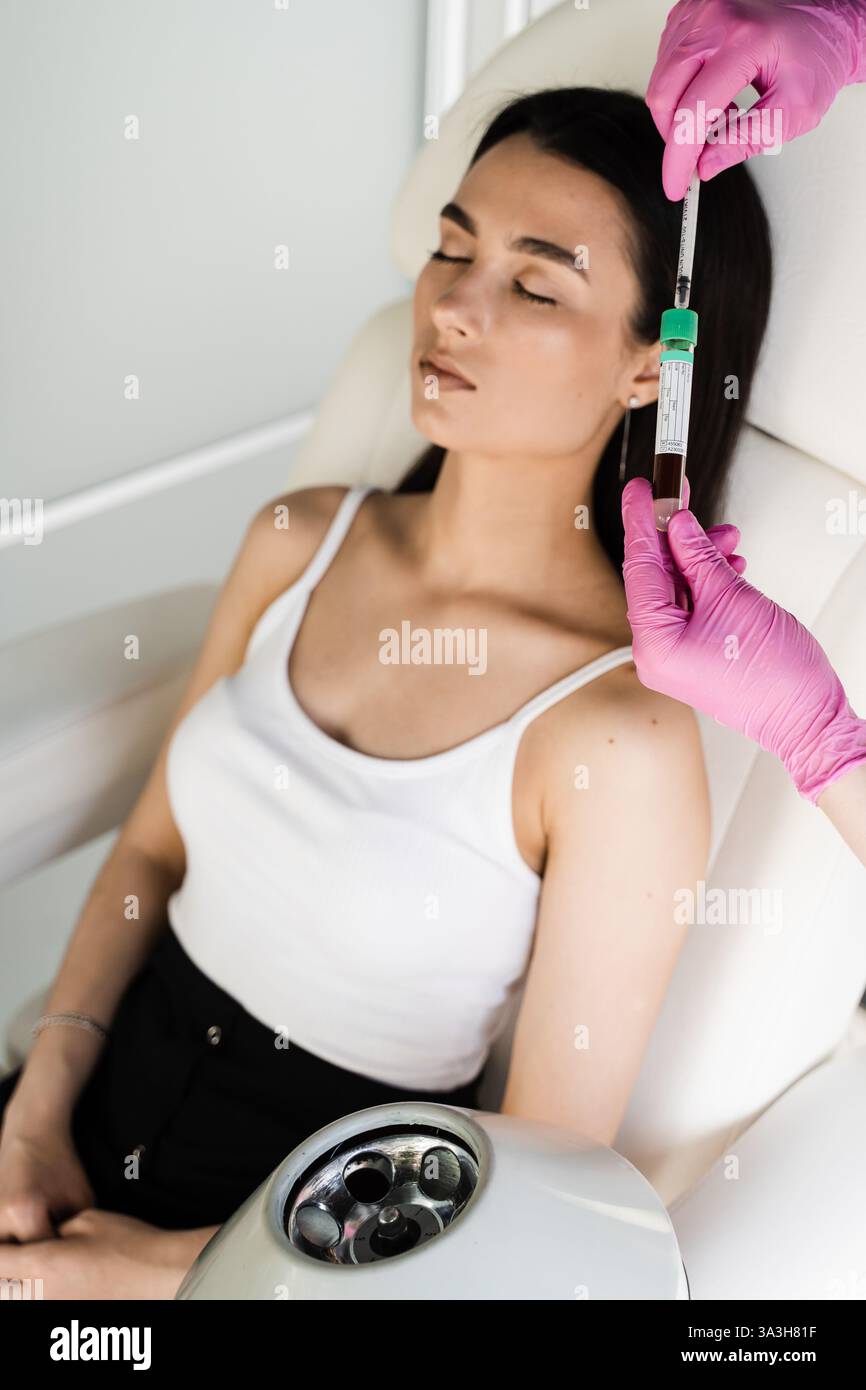 Cosmetologist with test tube with blood and plasma for PRP Platelet ...