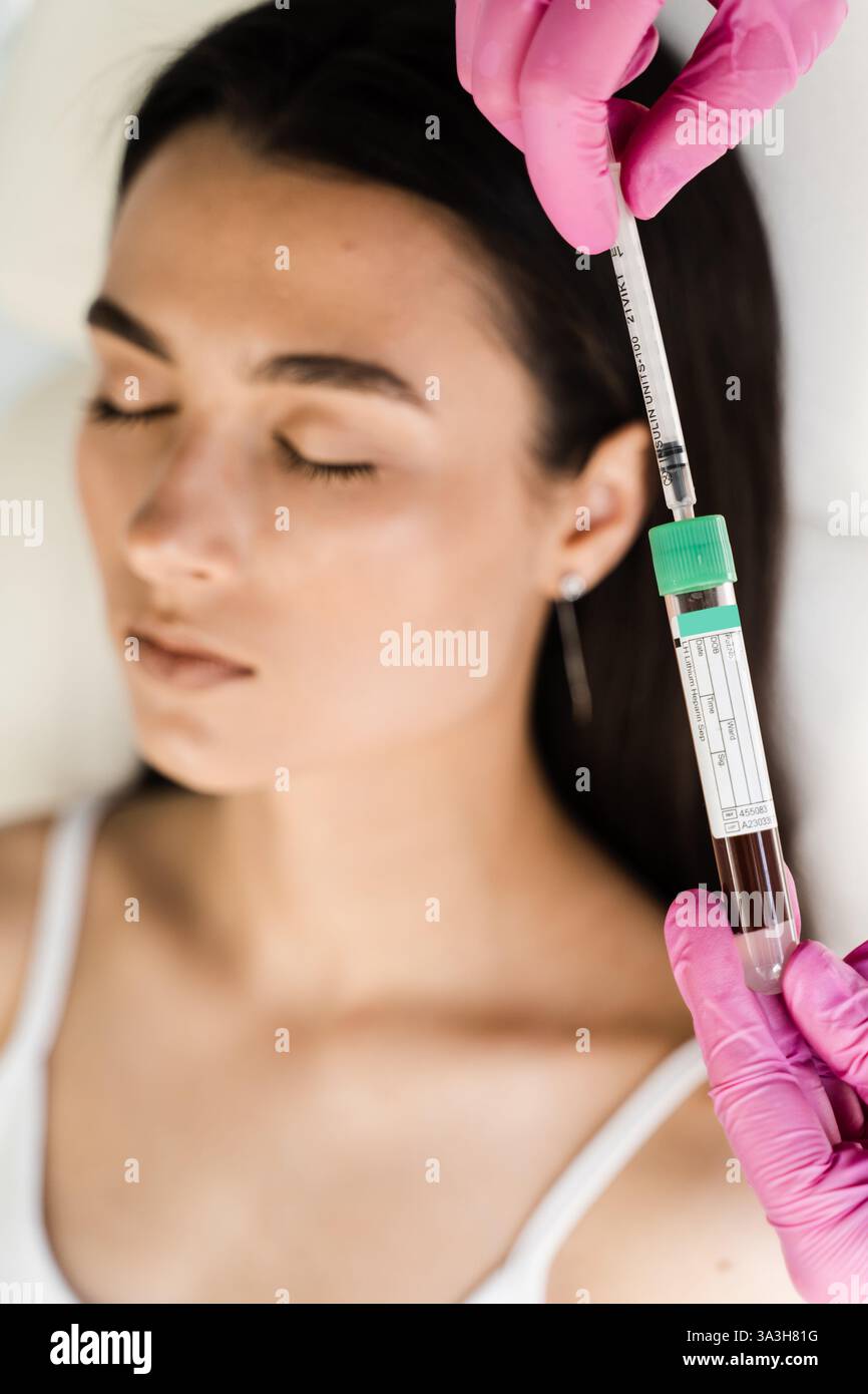 Platelet Rich Plasma PRP for improves skin volume and texture, reduces ...