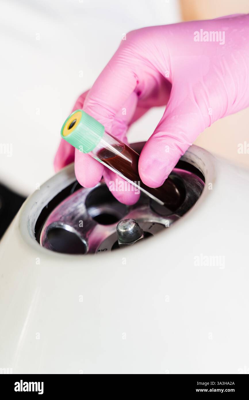 Cosmetologist insert test tube with blood in centrifuge to get plasma ...