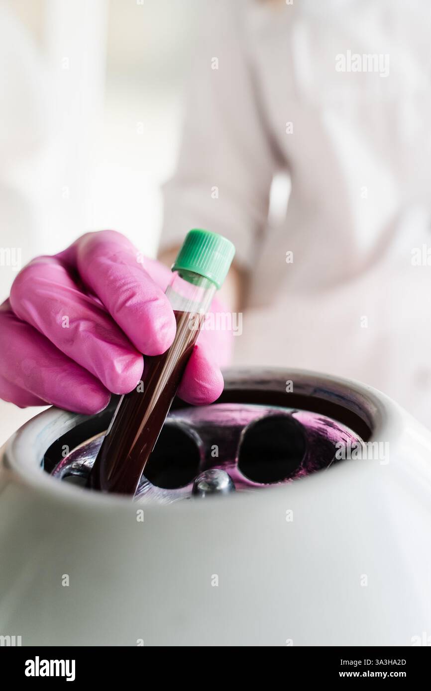 Close-up inserting test tube with blood in centrifuge to get plasma of ...