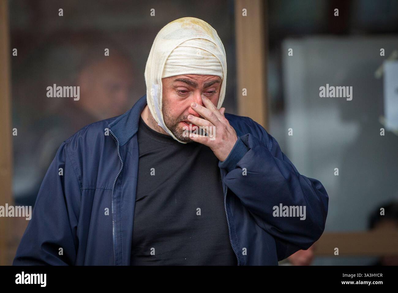 An injured man exits a hospital in the town of Kocani, North Macedonia ...