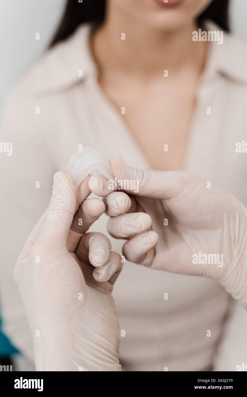 Nasal splints are installed in the nose during septoplasty to correct ...