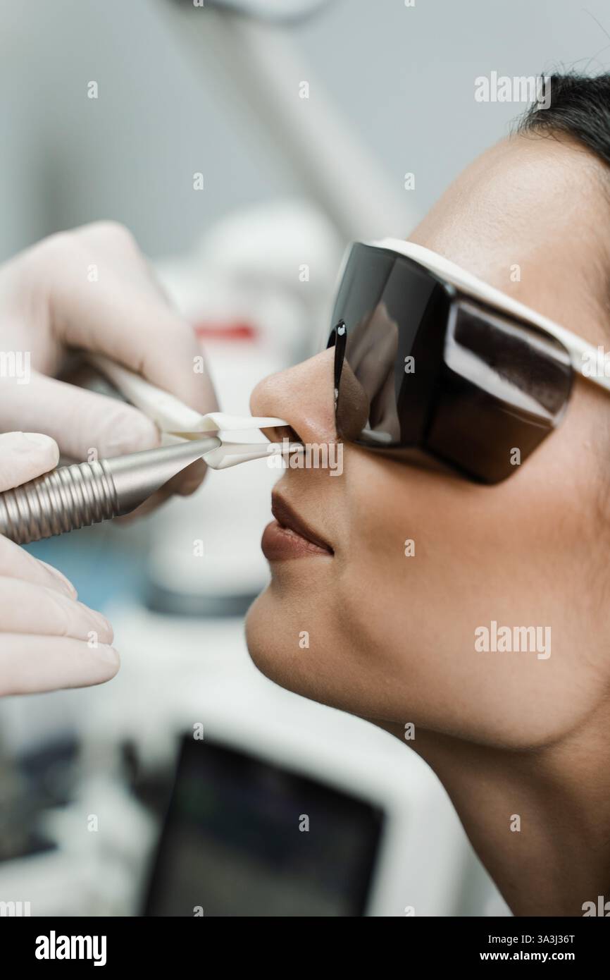 Laser treatment inflammation of the nasal lining, runny nose, sneezing ...