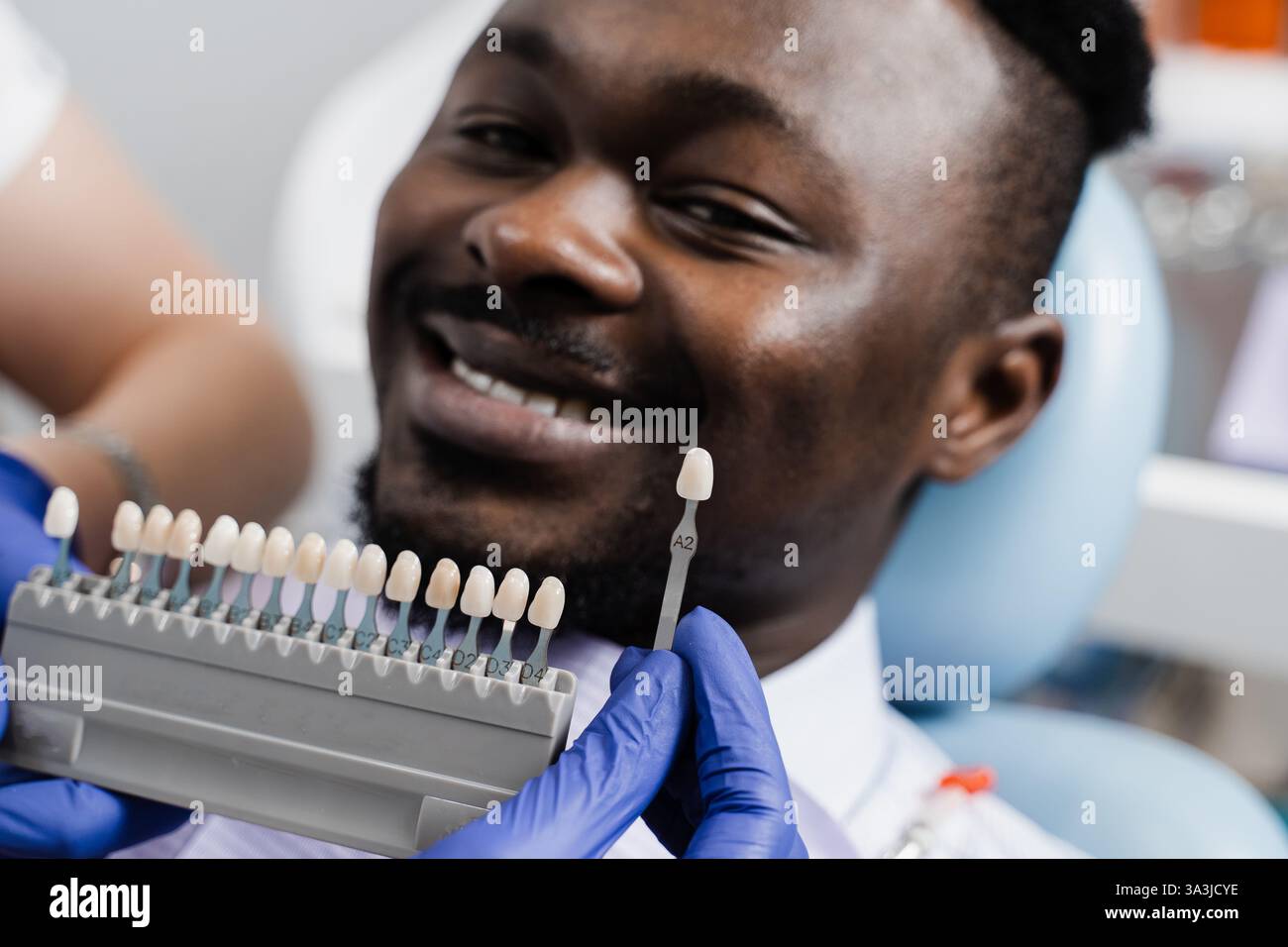 Teeth color shades guide close-up. African man in dentistry. Veneers or ...