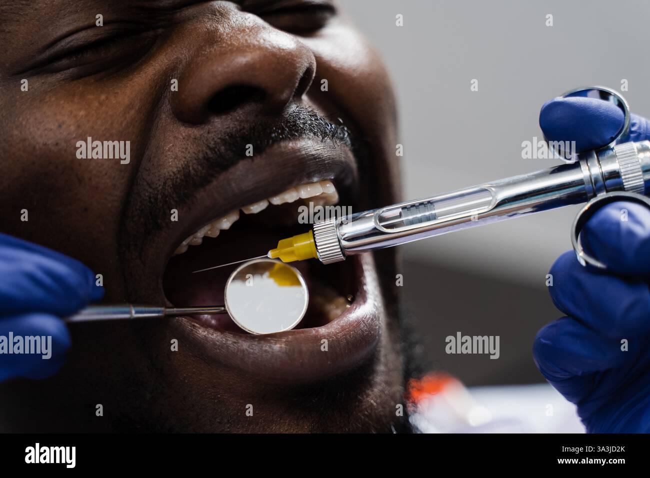 Anesthesia syringe injection close-up. Dentist injects syringe with ...