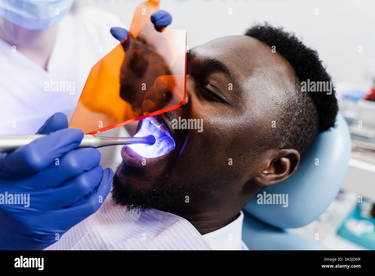 Dentist treats and removes caries in african man patient. Uv ...