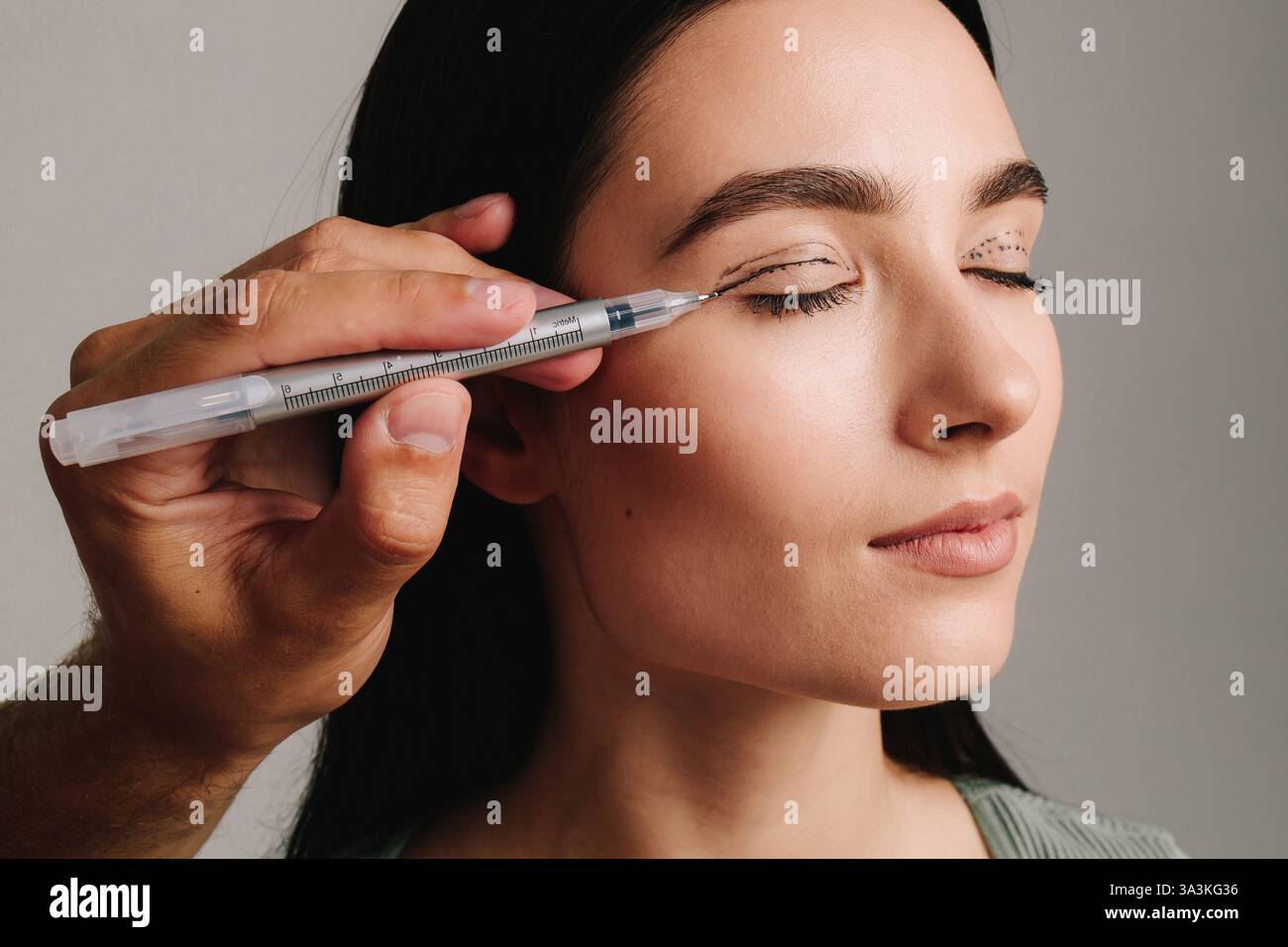 Surgeon is planning process of upper blepharoplasty with marker ...