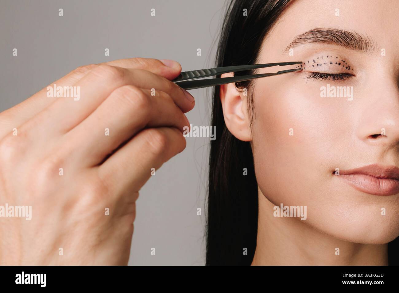 Blepharoplasty markup close-up on the face before the plastic surgery ...