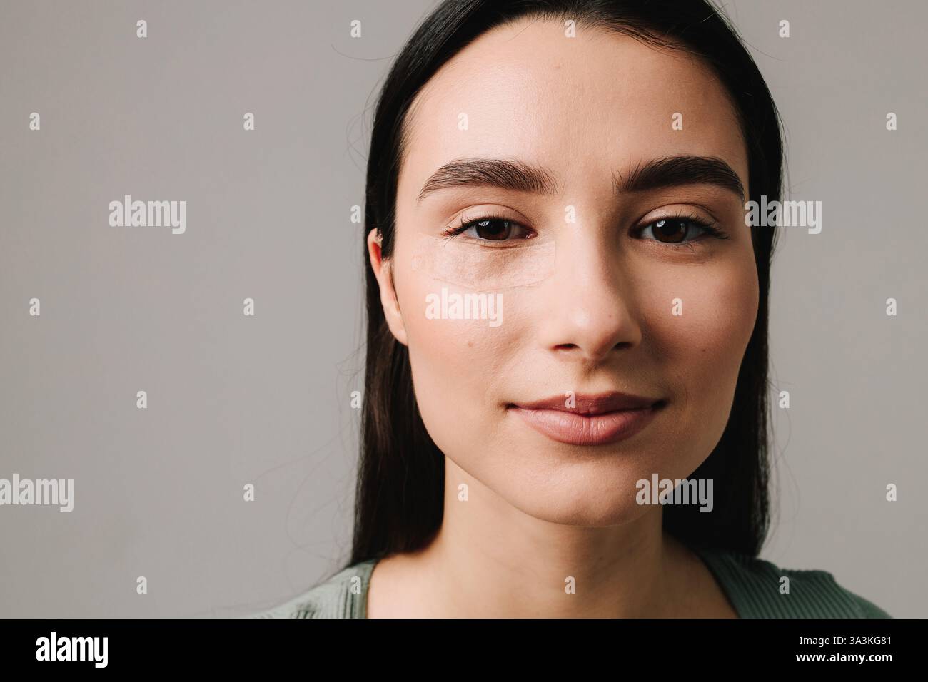 Eye lids surgery blepharoplasty to remove eye bags and cope with aging ...