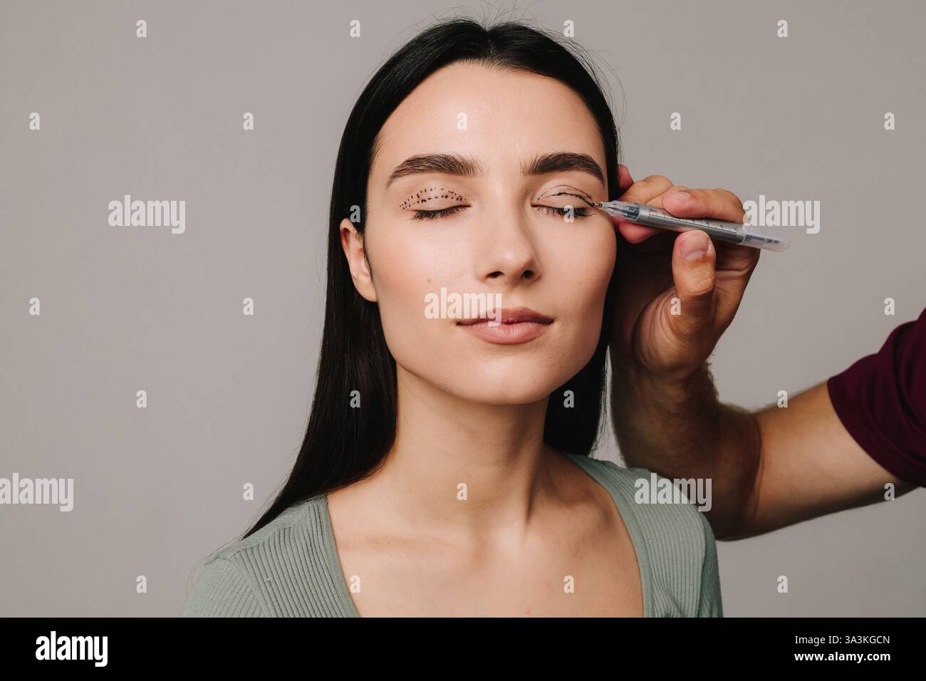 Surgeon is planning upper blepharoplasty with marker. Surgeon is ...