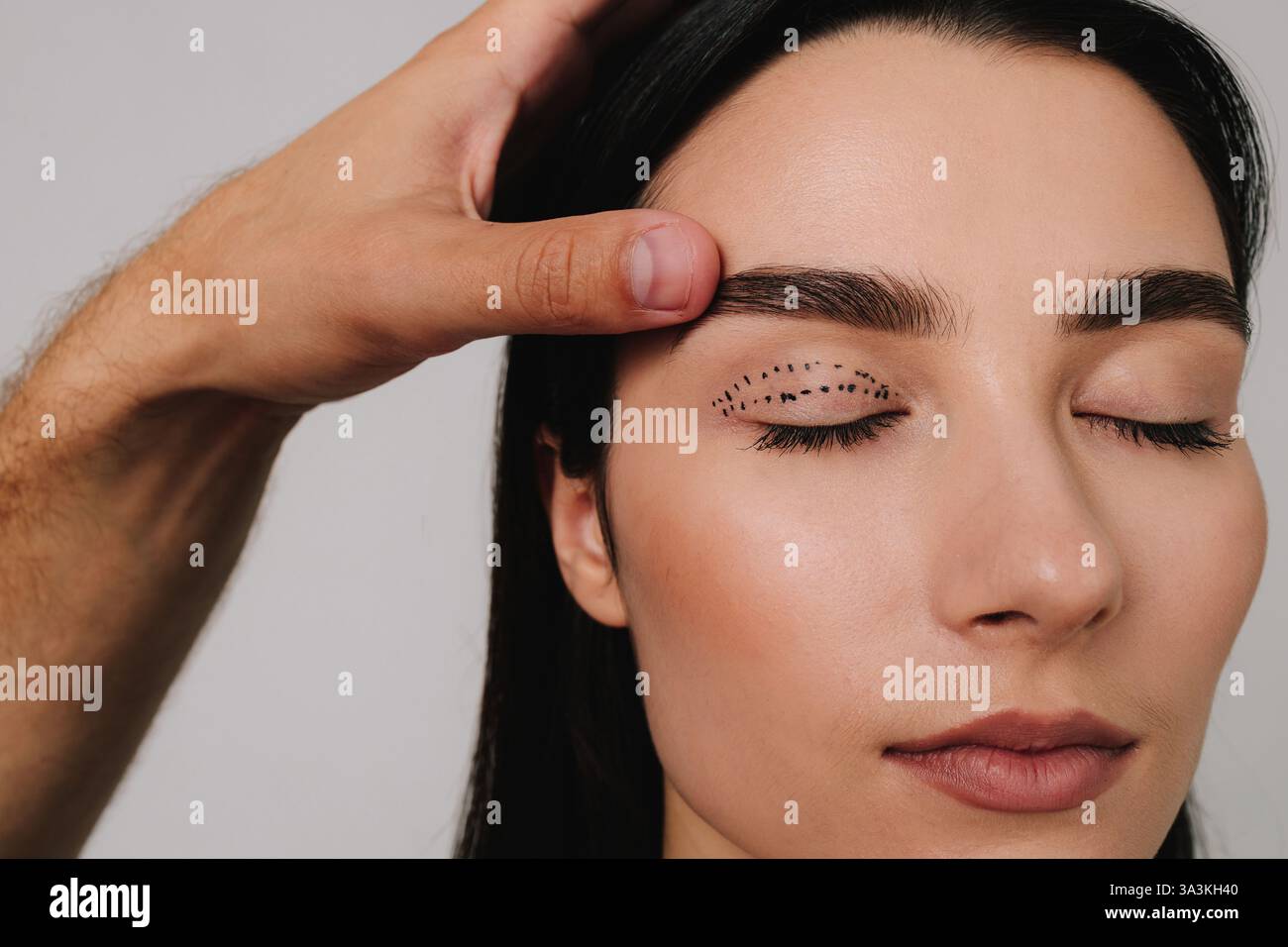 Marking blepharoplasty. Doctor is drawing up plan for upper eye lid ...