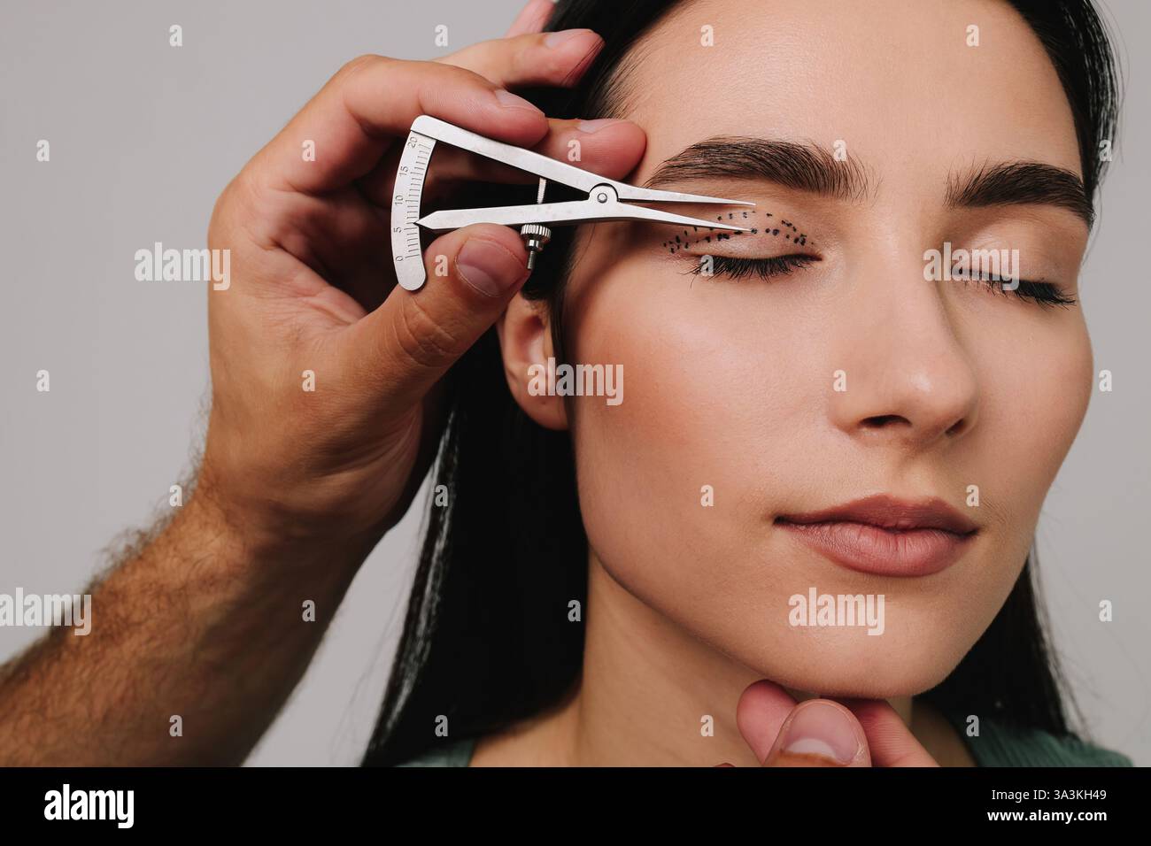 Preparing for blepharoplasty to correct droopy eye lids. Upper ...