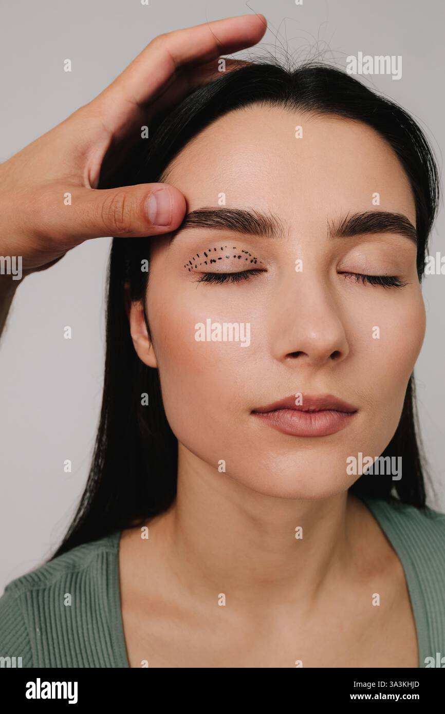 Blepharoplasty mark up. Lifting eye lids with precise planning. Doctor ...