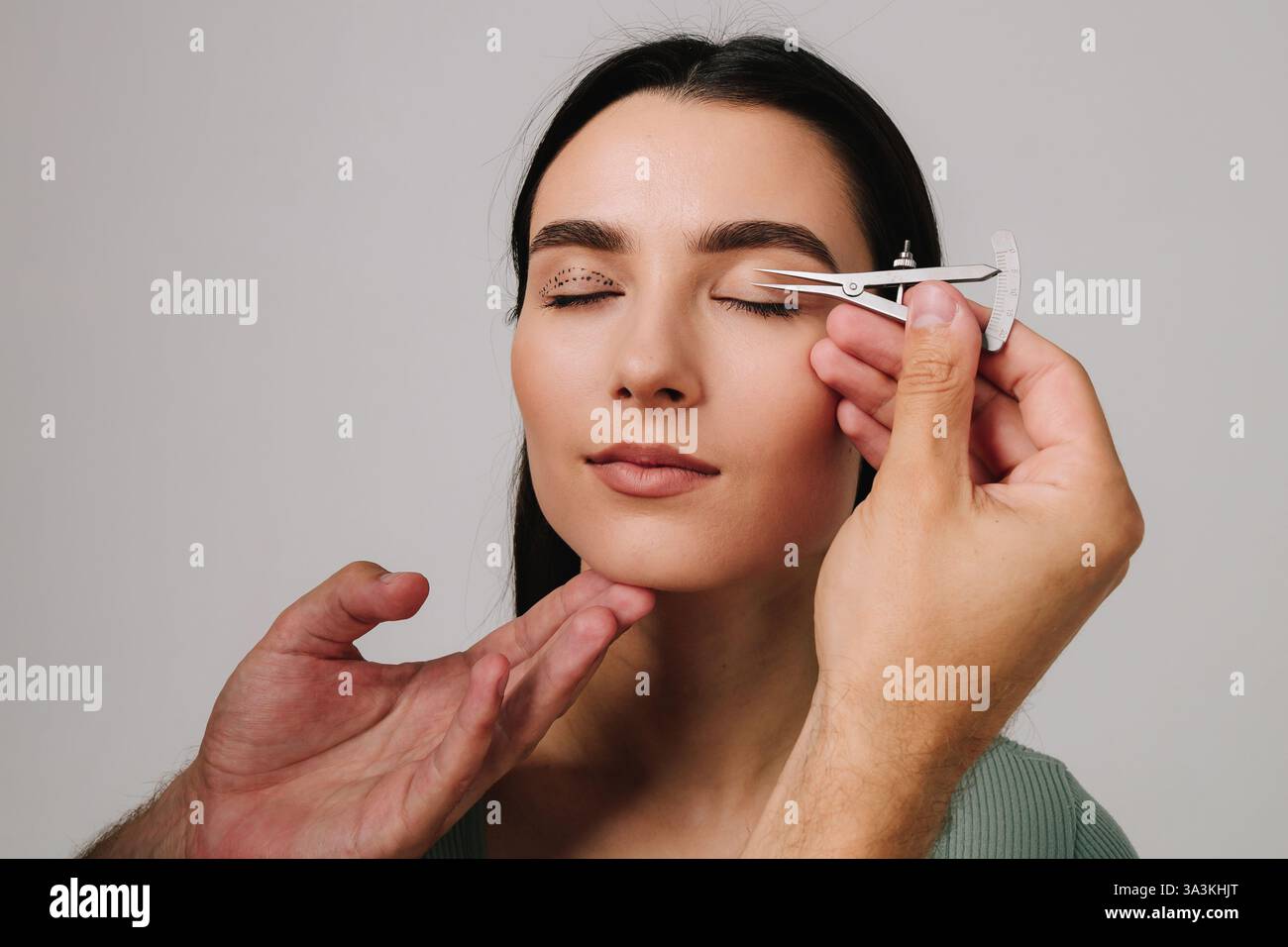 Preparing for blepharoplasty to correct droopy eye lids. Upper ...