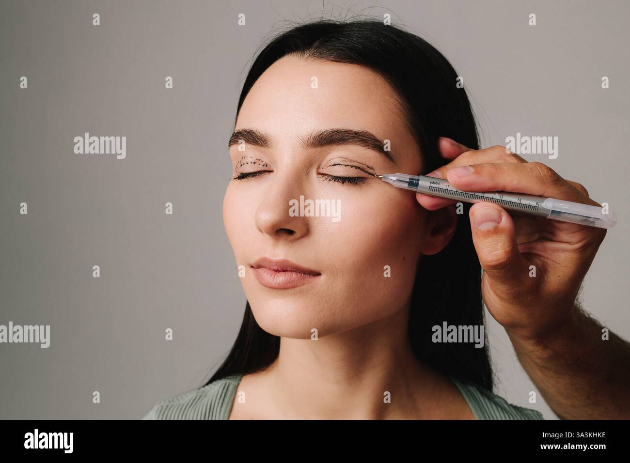 Blepharoplasty markup close-up on the face before the plastic surgery ...