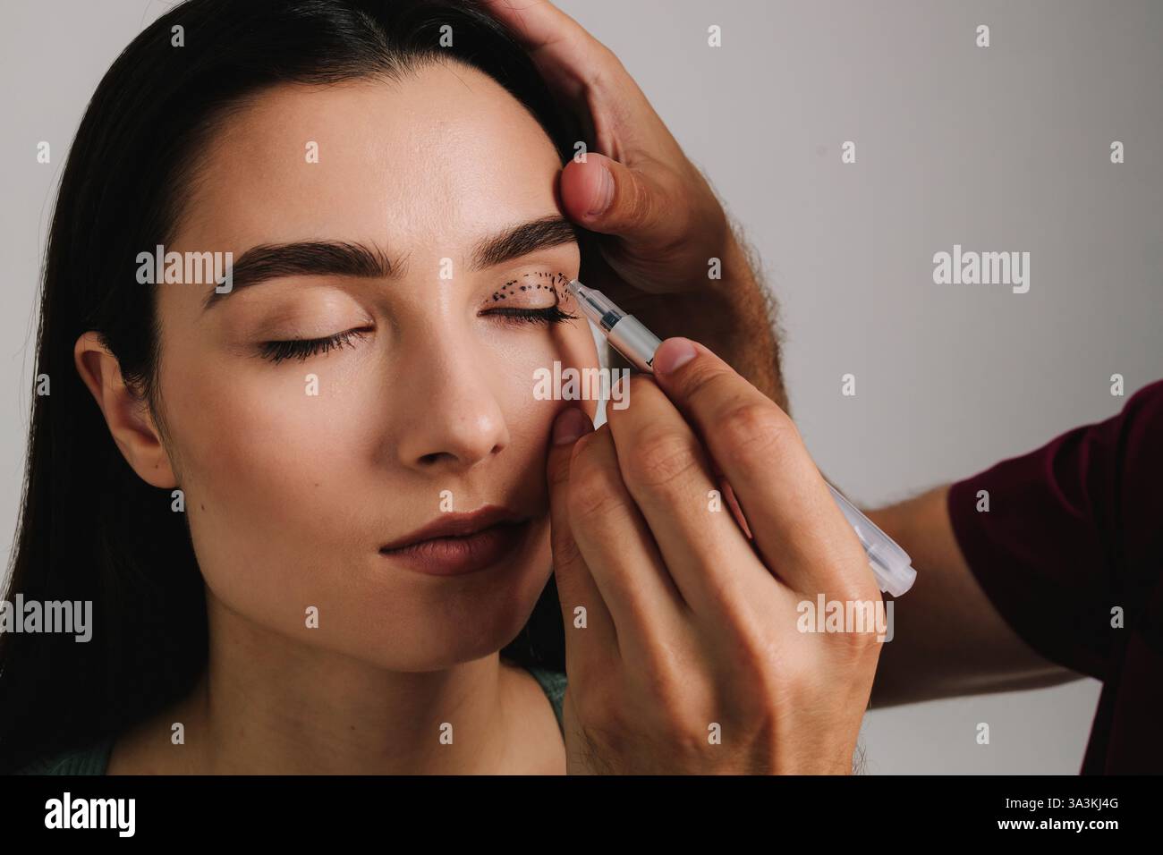 Blepharoplasty. Drawing on skin of eyelids for accurate face lifting ...