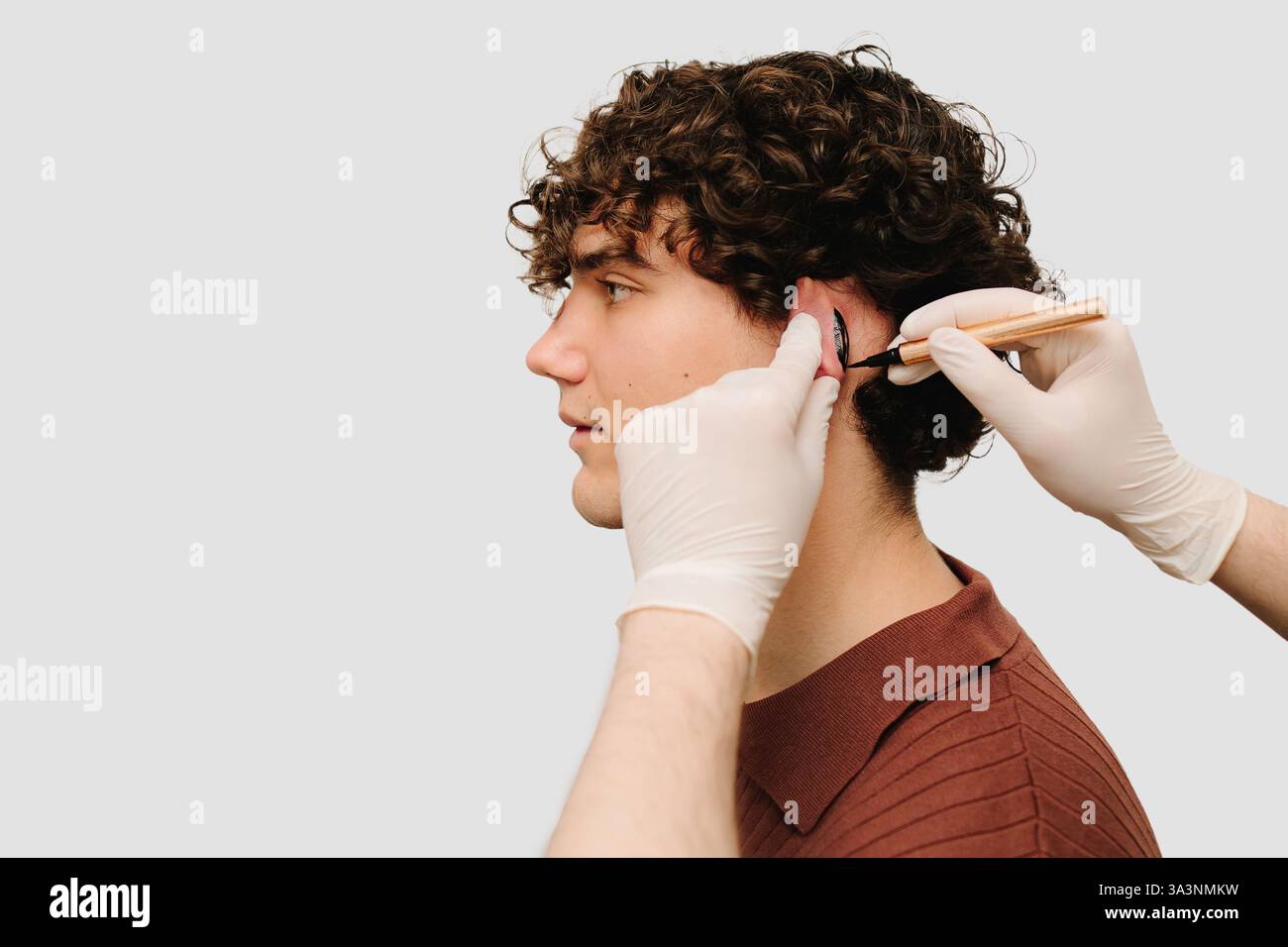 Otoplasty surgery markup ear. The doctor drawing mark up lines before ...