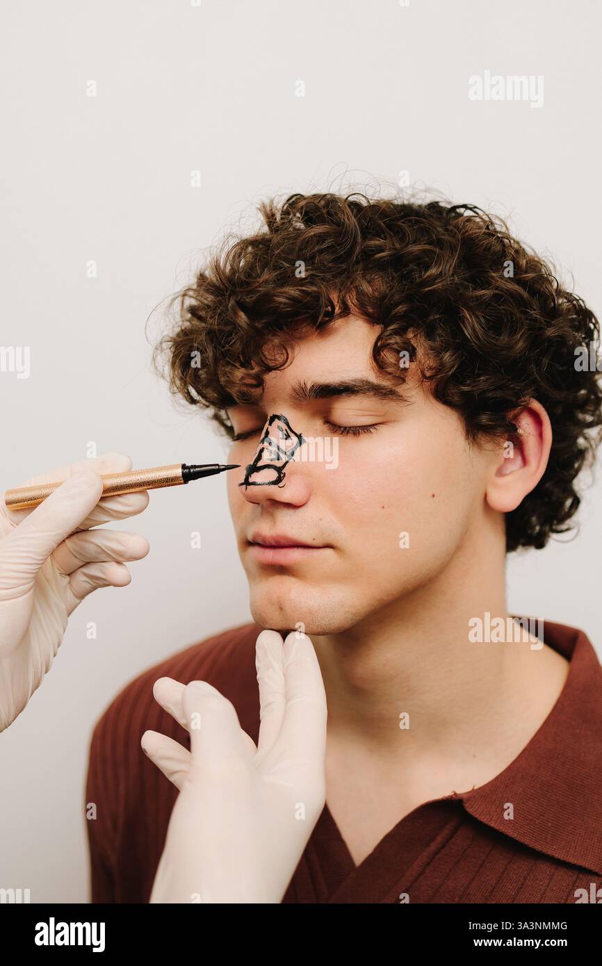 Surgeon drawing markup on nose before rhinoplasty surgery. Preparation ...