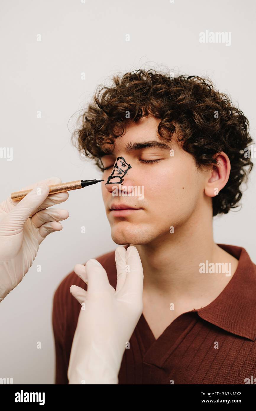 Process of drawing markup on male nose before rhinoplasty and ...