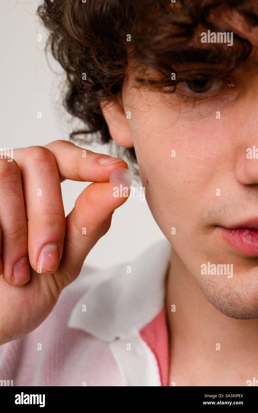 Dermatological acne patches or stickers to absorb excess fluids from ...