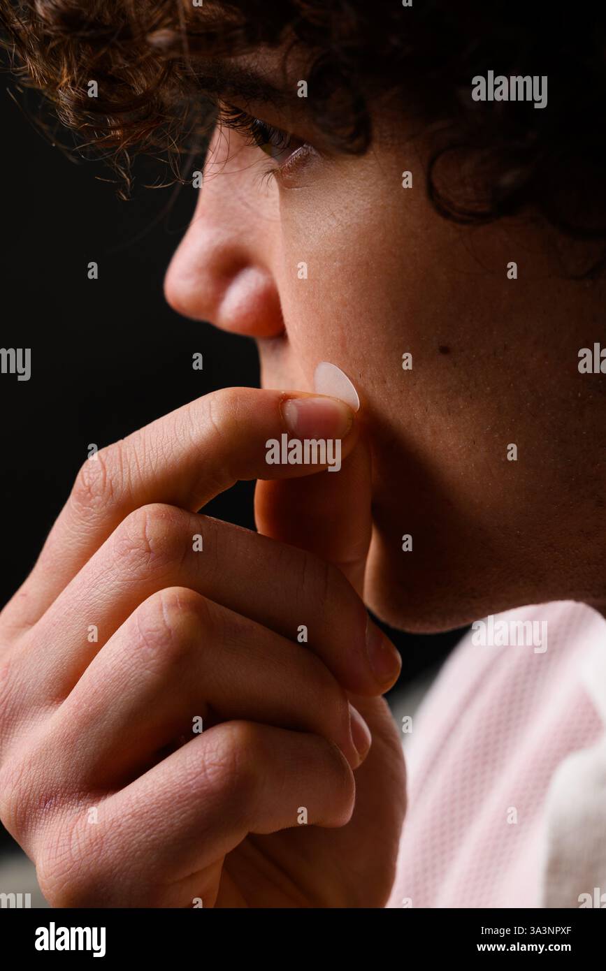 Using acne pimple patch to clean the face from zits. Young man uses ...