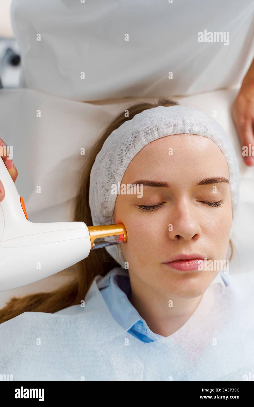 Removal rosacea of dilated small vessels on patient face with IPL ...