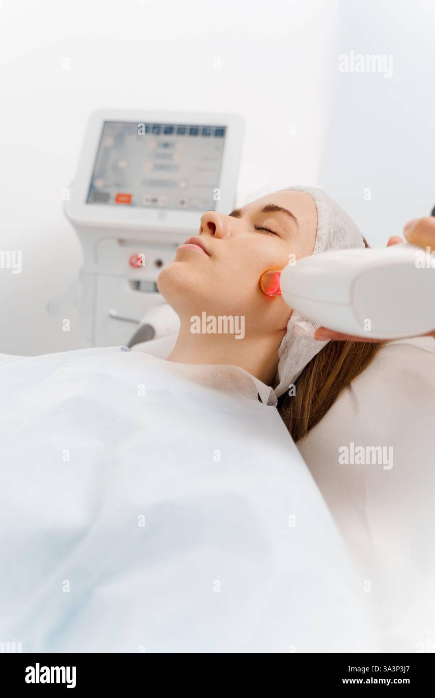 Removal rosacea of dilated small vessels on patient face with IPL ...