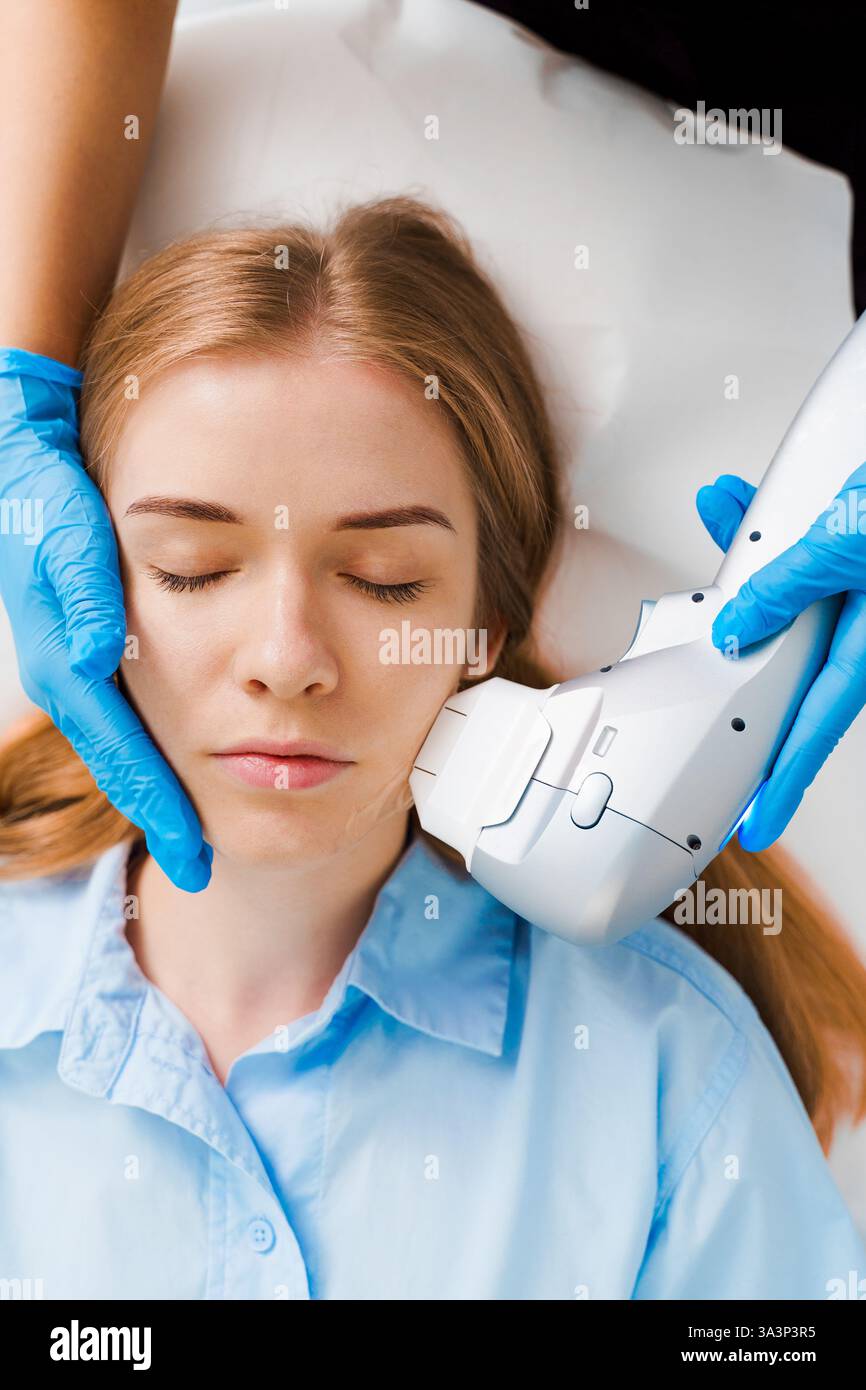 IPL laser acne treatment on woman' s face in the dermatology clinic ...